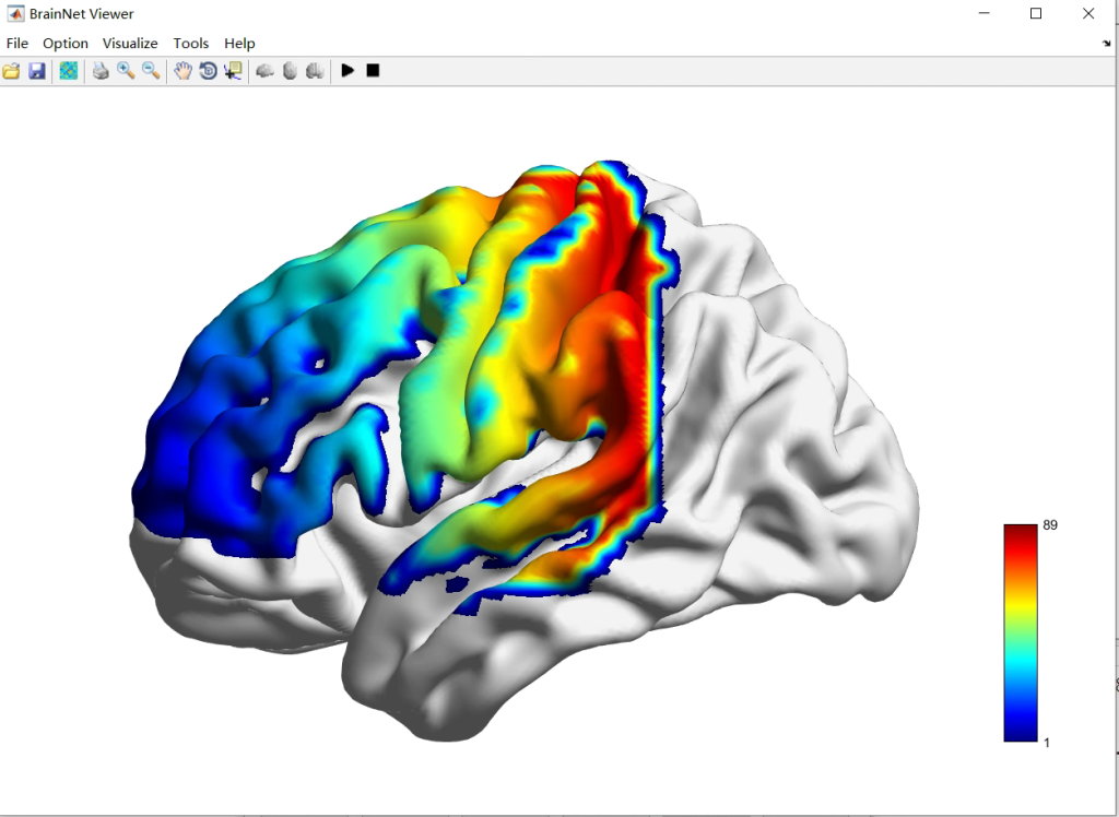 【BrainNet】绘制激活图（20250208更新） – Hello Brain