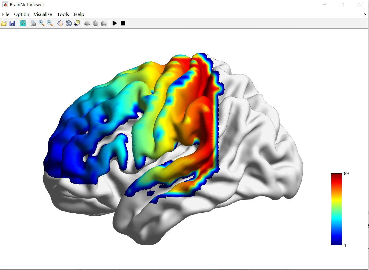 【BrainNet】绘制激活图（20250208更新） – Hello Brain